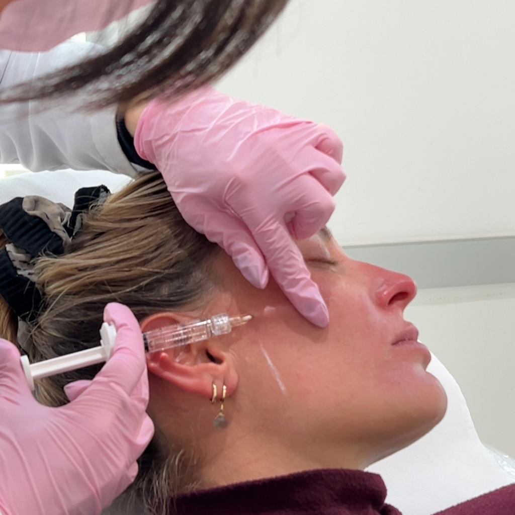 Profhilo Structura – Beauty Technique